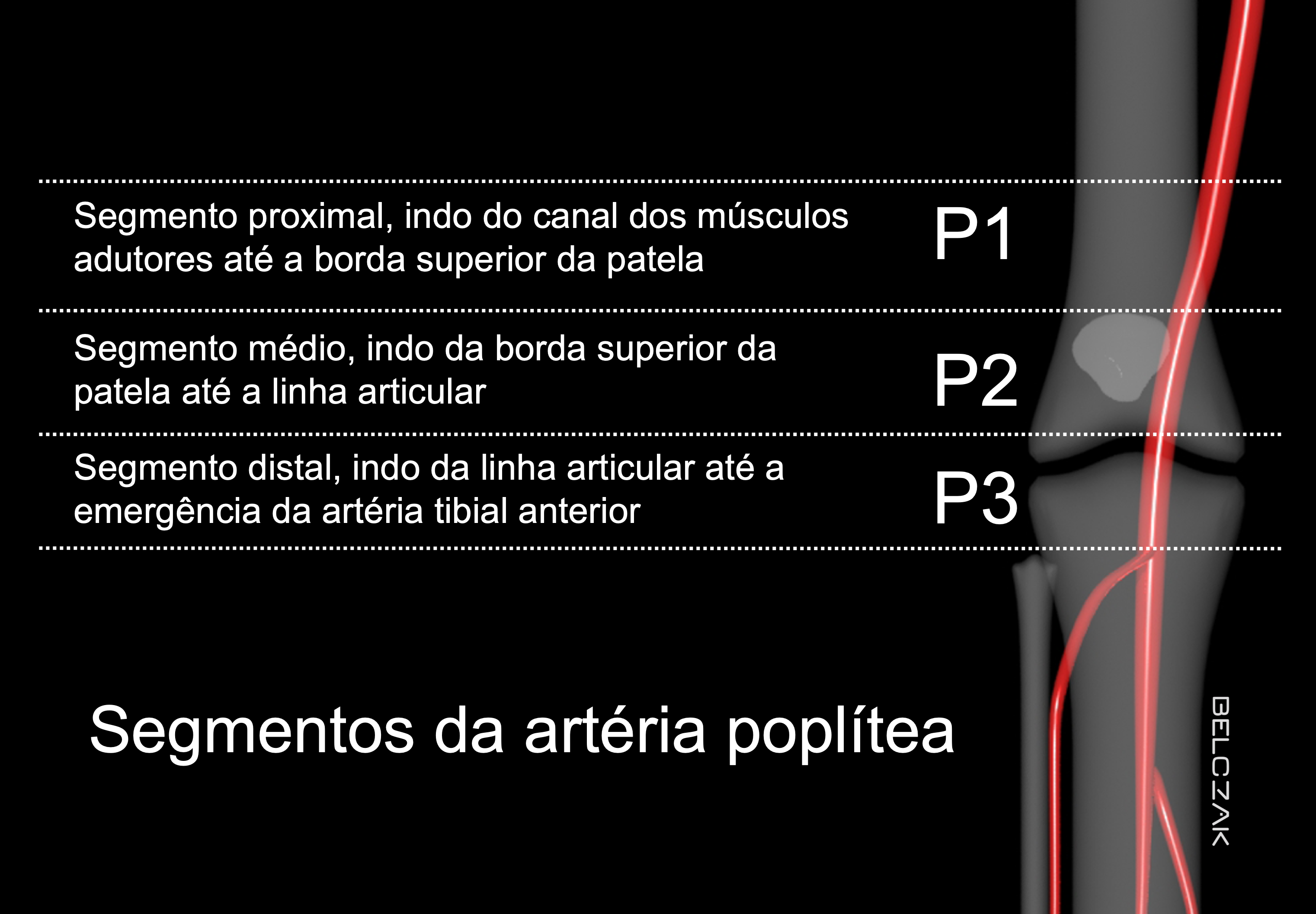 Segmentos da artéria poplítea - Instituto Belczak